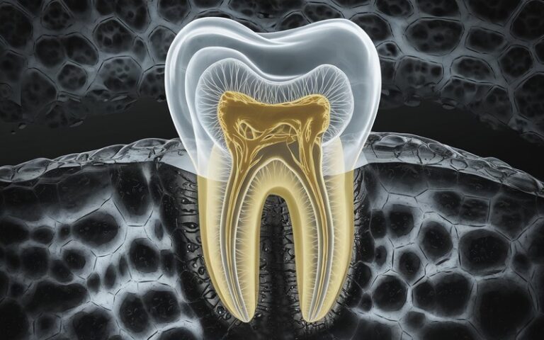 What Causes Tooth Enamel Defects? - Lifeworks Dental